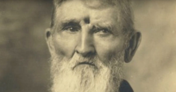 Jacob Miller Volunteered To Fight For The Union, Was Shot In The Head ...